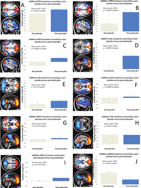 Default Mode Network Resting State Network Dmn Rsn Connectivity After Download Scientific