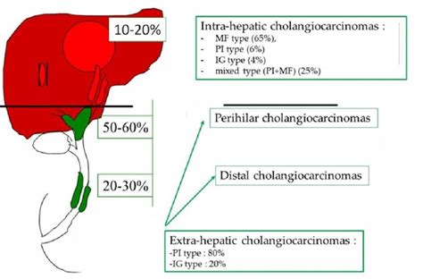 Localization Distribution And Frequency Of The Macroscopic Type Of Localization Distribution And Frequency Of The Macroscopic Type Of