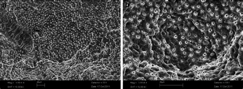 Sem Of The Dentin Surfaces Pretreated With Eryag Laser Irradiation A Download Scientific