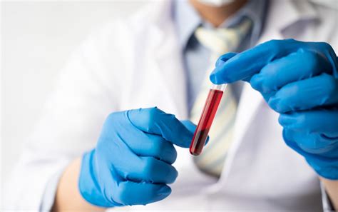 Cea Test Fem Surgery