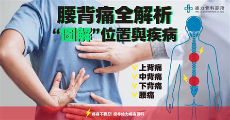 維力骨科診所 腰背痛全解析；上背痛、中背痛、下背痛、腰痛，圖解位置與疾病 Facebook