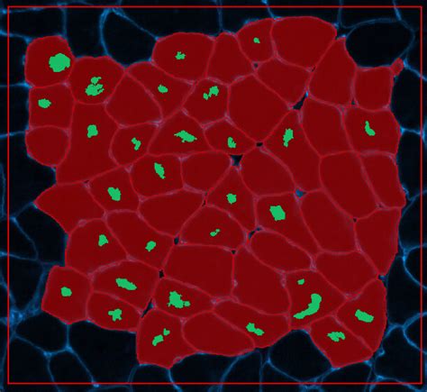 Subcellular Detection After Cellpose Segmentation Image Analysis Image Sc Forum