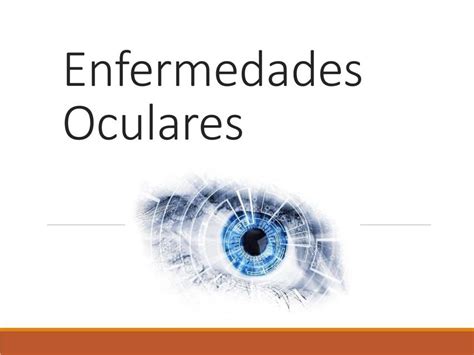 Enfermedades Oculares Felisa Ivania Gomez Garcia Udocz