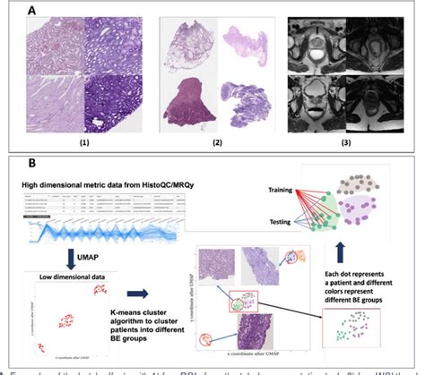 Cohortfinder An Open Source Tool For Data Driven Partitioning Of Biomedical Image Cohorts To