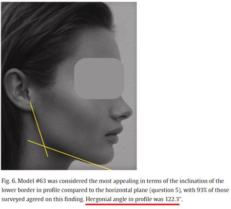 How A Sharp Or Moderate Jaw Angle Influence Perceived Attractiveness For Female PinkMirror Blog