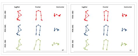 Interaction Of Sex And Age Effects In Walking Pattern Differentiation Of Sex And Age Effects To