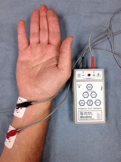 Reversal Antagonism Of Neuromuscular Blockade Clinical Tree
