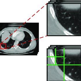 Structure Of The Proposed Lung Nodule Detection Model Download Scientific Diagram