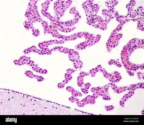 Histologie Système Nerveux Central Banque De Photographies Et Dimages à Haute Résolution Alamy