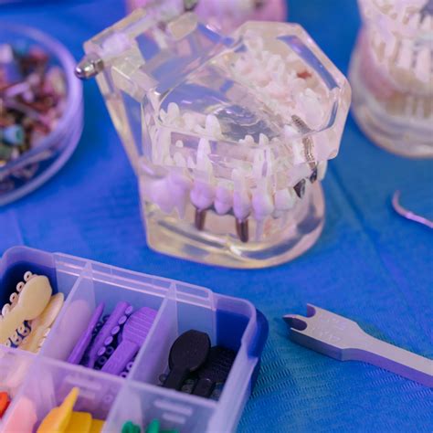 Kesan Getah Braces Tercabut Verde Amani Dental Care