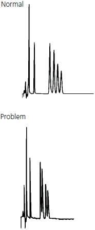 HPLC Troubleshooting Guide