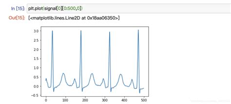 Wfdb—心电信号降采样wfdbprocessing Csdn博客