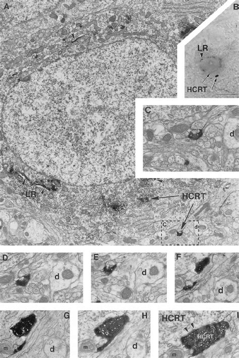 A Hypocretin Axon Innervates A Hypocretin Neuron Containing Leptin Download Scientific Diagram
