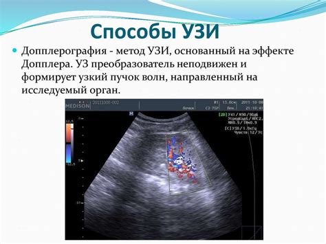 УЗИ ультразвуковое исследование презентация онлайн