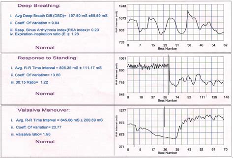 Evaluation Of Cardiac Autonomic Function In Overweight Males Advances In Human Biology