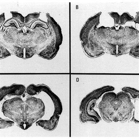 Bar Histogram Showing Delayed Nonmatching To Sample Choice Accuracy Download Scientific Diagram