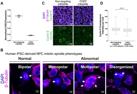 Figure S2 Chd2 Knockdown Validation Spindle Defect Examples And Download Scientific Diagram