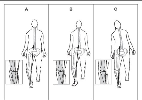 Figure 1 From Lateral Trunk Lean Explains Variation In Dynamic Knee
