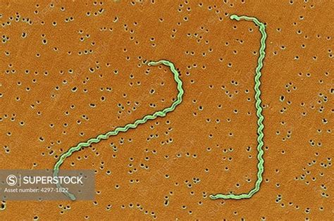 Scanning Electron Micrograph Of Leptospira Interrogans Strain Rga Showing Two Spirochetes Bound