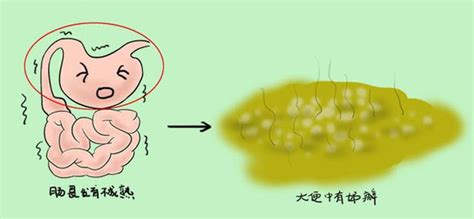 婴儿大便卡通 宝宝积食后拉的图 宝宝卡通 大山谷图库