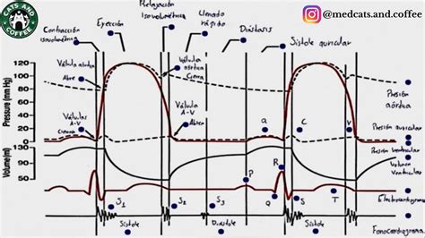 Cardiología Udocz