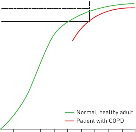 Oxyhaemoglobin Dissociation Curve For Healthy Individuals And Patients