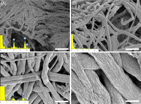 Scanning Electron Micrographs Comparison Of The Microstructure Of The Download Scientific