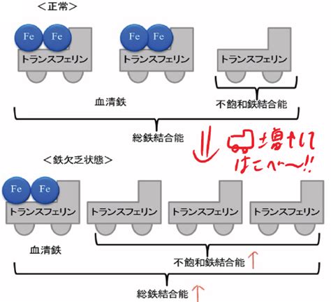 鉄欠乏性貧血：赤血球の運搬方法と中身・大きさがポイント マインドマップ薬学