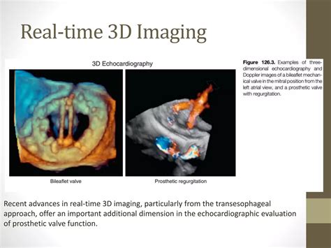 Assessment Of Prosthetic Valve Function Pptx