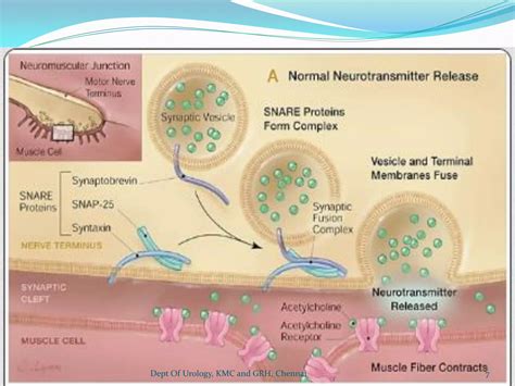 Uro Gynacology Botox PDF Brain And Nervous System Disorders Diseases And Conditions