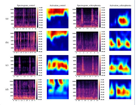 The Spectrogram And Corresponding Activation Map Of Normal Speech And Download Scientific