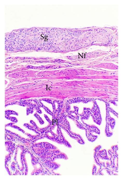 Photomicrographs Of The Prostatic Capsule During Winter Showing Fine Download Scientific