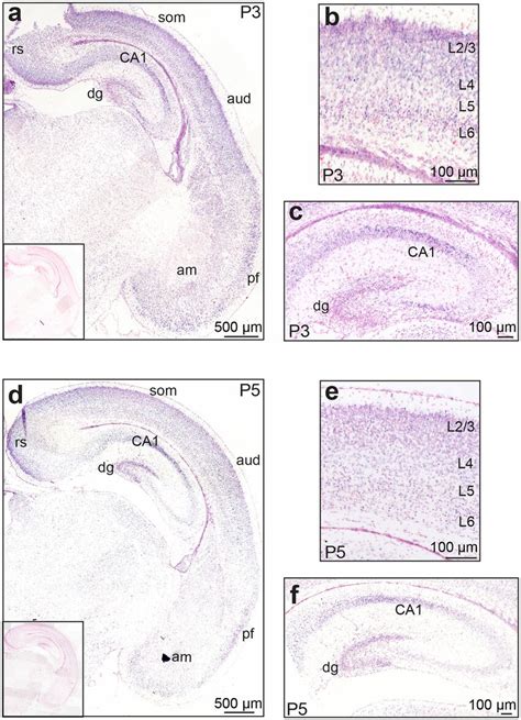 Ryk Is Expressed In The Neocortex And Hippocampus During Download