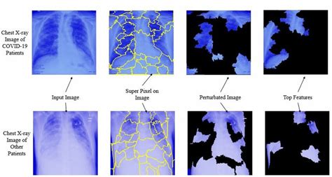 Overall Prediction Analysis Using Local Interpretable Model Agnostic