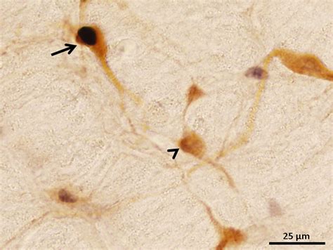 Representative C Fos Positive And C Fos Negative Noradrenergic Neurons Download Scientific