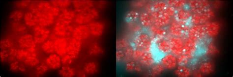 A Autoflorescent View Of Botryococcus Braunii On Aluminum And B Download Scientific Diagram