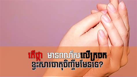 ផ្កាពណ៌សលើក្រចក តើវាពិតជាមានន័យថាខ្វះសារធាតុចិញ្ចឹមមែនទេ