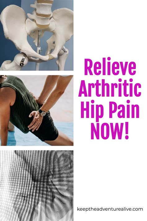 5 Exercises To Relieve Hip Arthritis Pain Artofit
