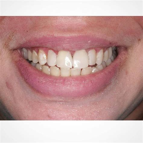 Drezzy Dental Clinics Hurghada