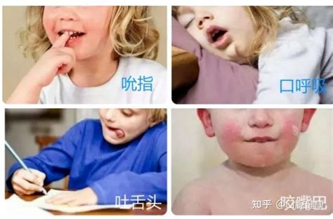 孩子门牙连面条都咬不断开颌的人生到底有多惨 知乎