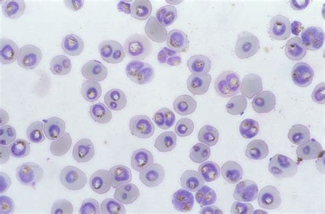 Plasmodium Types