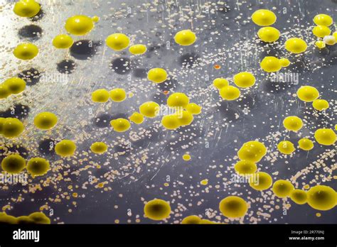 Bacteria Grown From A Skin Smear Colonies Of Micrococcus Luteus And Staphylococcus Epidermidis