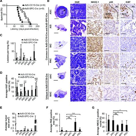Cell Of Origin Defines The Histopathology Spectrum And Associated