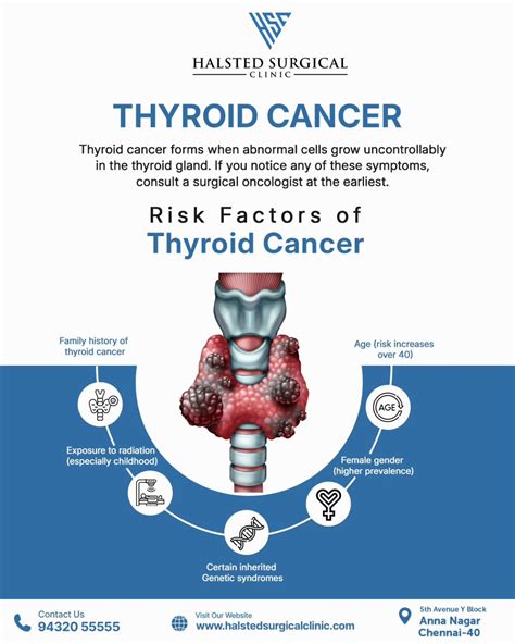 Halsted Understanding Thyroid Cancer Risks Thyroid Cancer Can Be