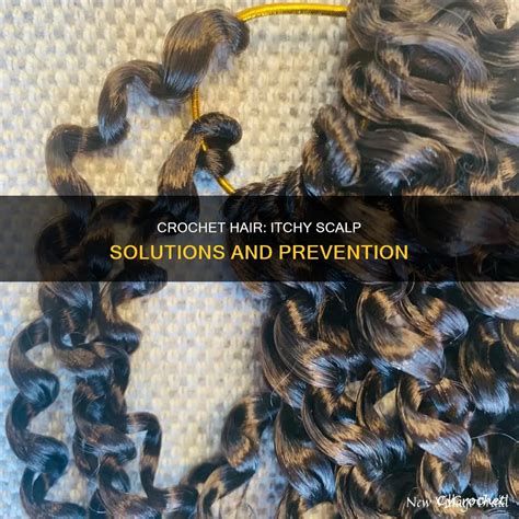 Crochet Hair Itchy Scalp Solutions And Prevention Cycrochet