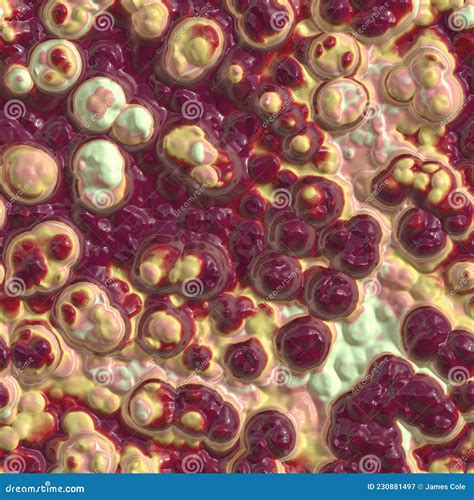 Pimple Pus Under Microscope Pimple Pus Under Microscope