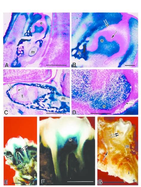 The Contribution Of Cnc Derived Cells During Tooth Morphogenesis