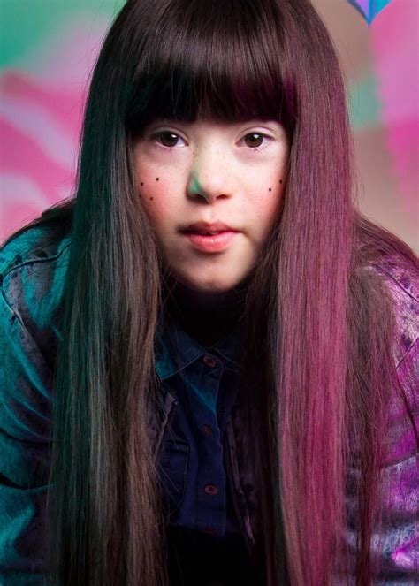 «Проект радикальной красоты показал что люди с синдромом Дауна тоже могут быть моделями