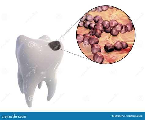 Streptococcus Mutans Bacteria Stock Illustration 78018781