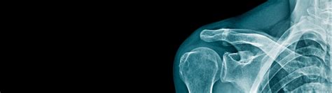 Ucla Researchers Use Machine Learning On Oci To Help Predict Surgical